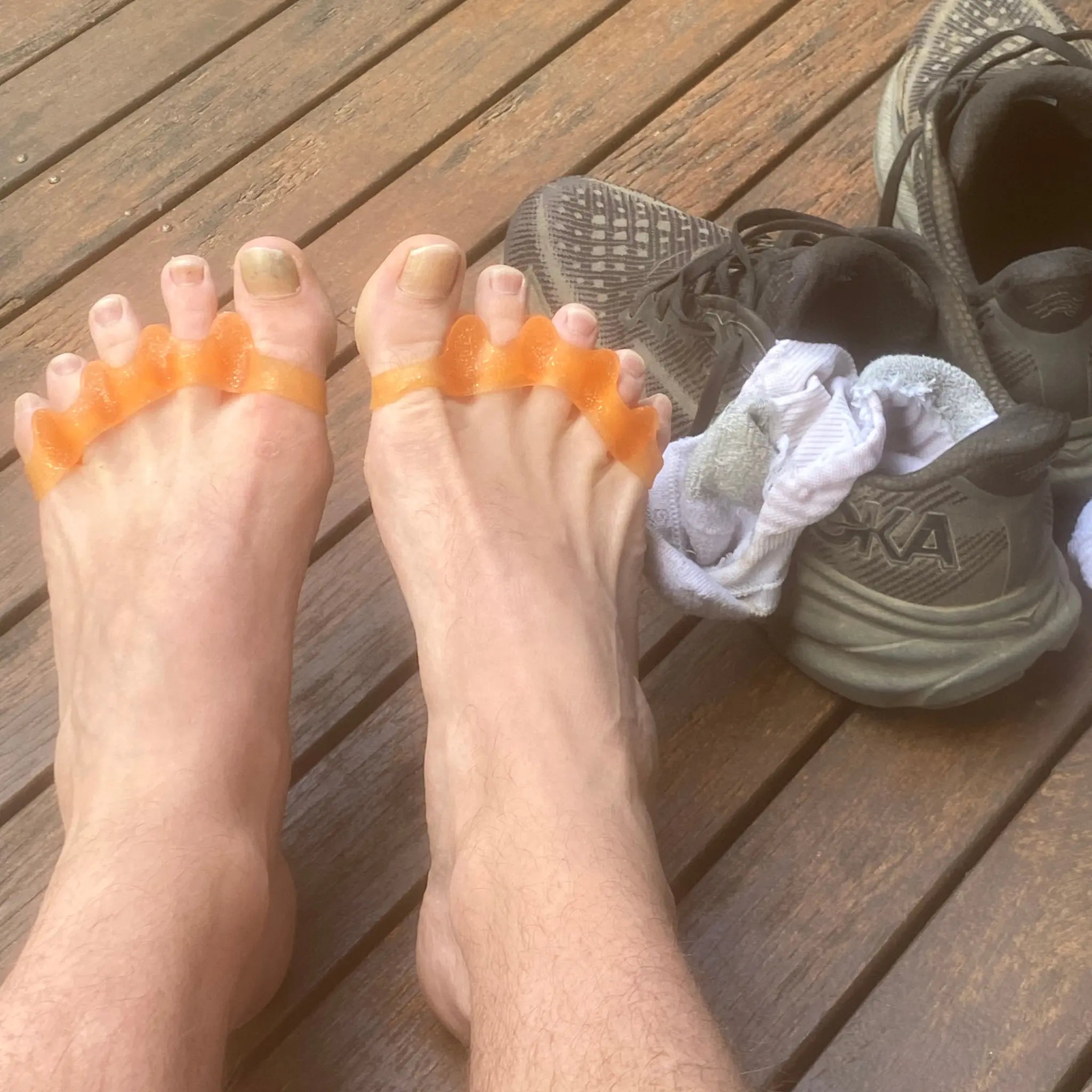 Toe Spreaders: Start spreading 'em with Tingle Toes today!